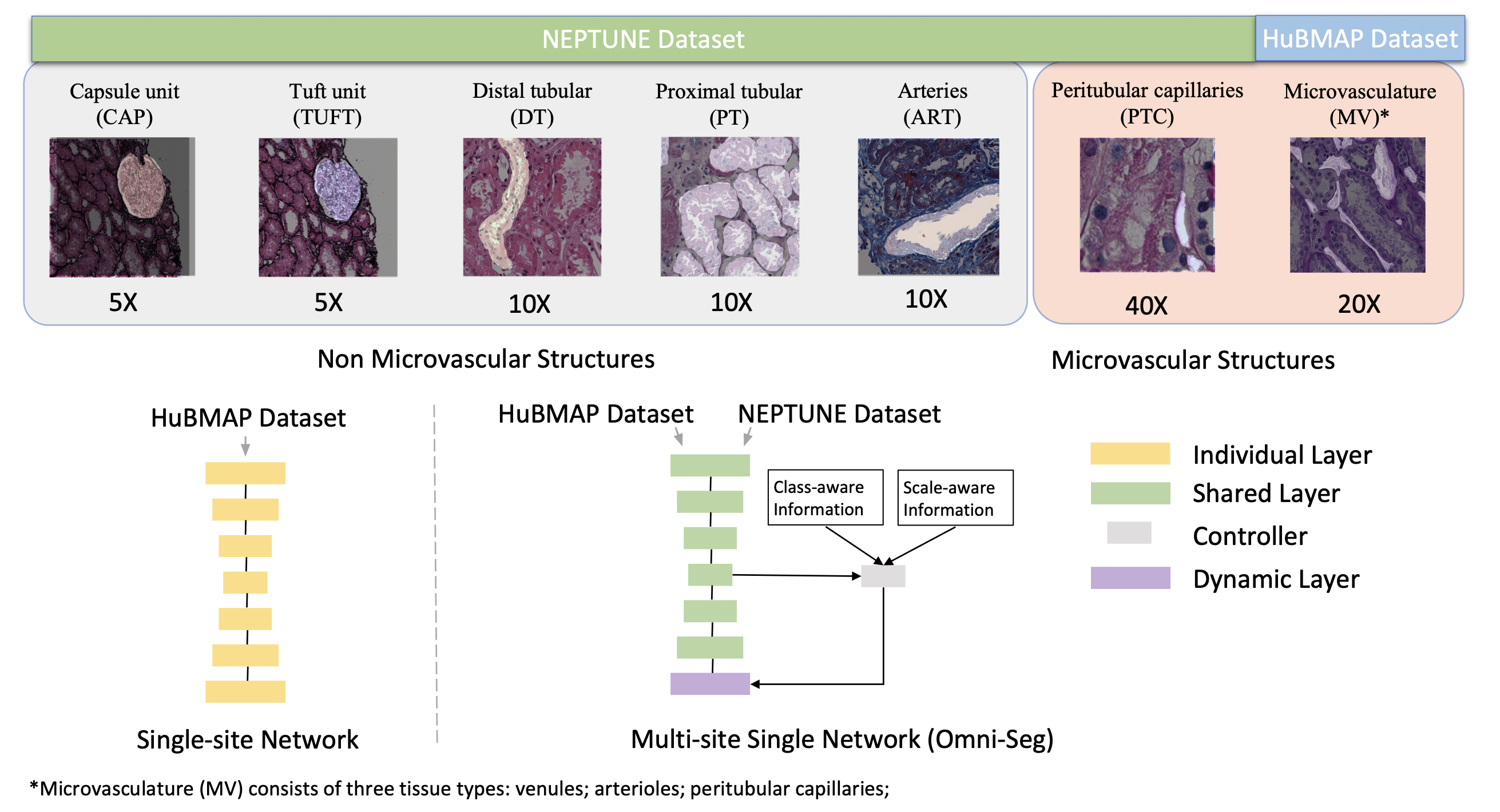 Multi-scale Multi-site Renal Microvascular Structures Segmentation for Whole Slide Imaging in ...